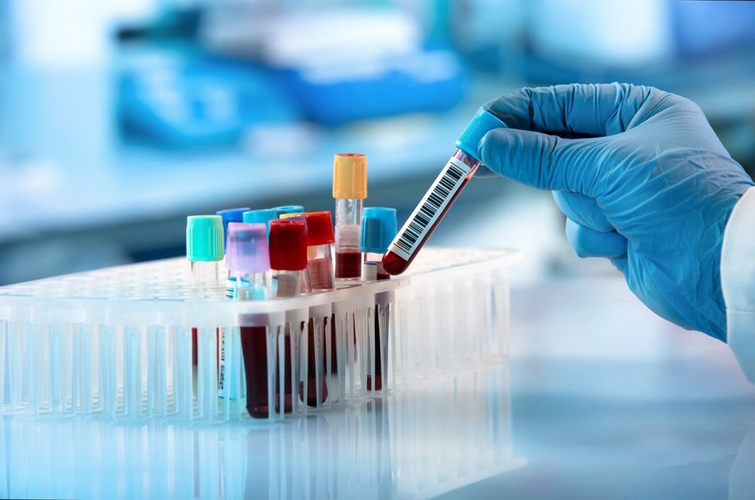 Comprendre les différents groupes sanguins du plus commun au plus rare ...